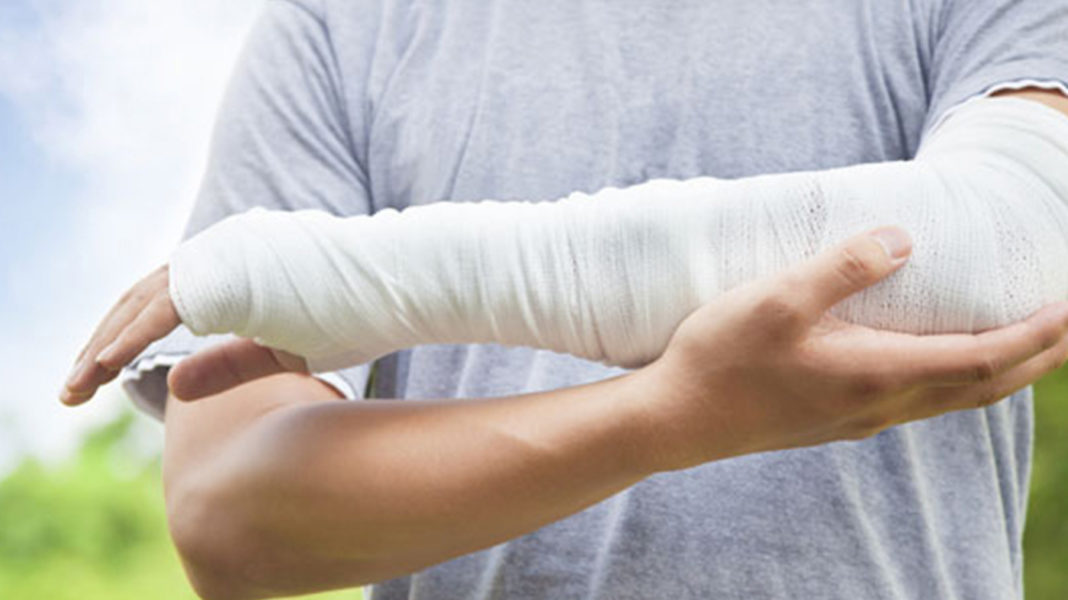 Facts and Prevention Tips for Commonly Seen Hand and Arm Injuries ...